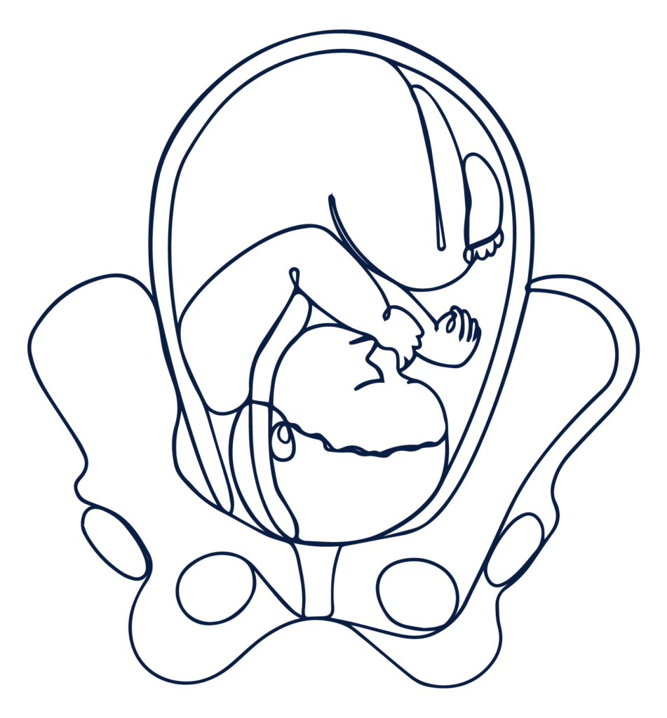 MATRONA – Kime Center